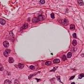 Matching Pairs: Histologia - Tecido Epitelial (medicina - biologia ...