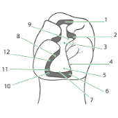 Memory: "Clasificacion de cavidades" (sociología - odontologia)