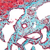 Print Matching Pairs: Tinciones (tejidos - tincion - histología)