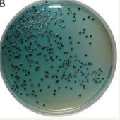 Matching Pairs: Enterobacterias (microbiología - enterobacterias ...