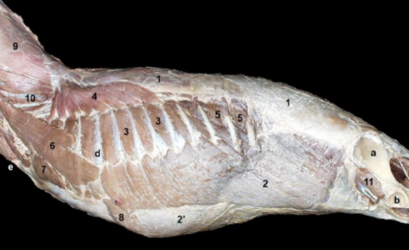 Print Map Quiz: Miología de tórax (miología de torax - anatomía del ...