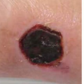 Matching Pairs: Lesiones dermatológicas JC (D) (clínicas médicas - 1 ...
