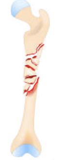 Matching Pairs: Fractures Matching Game