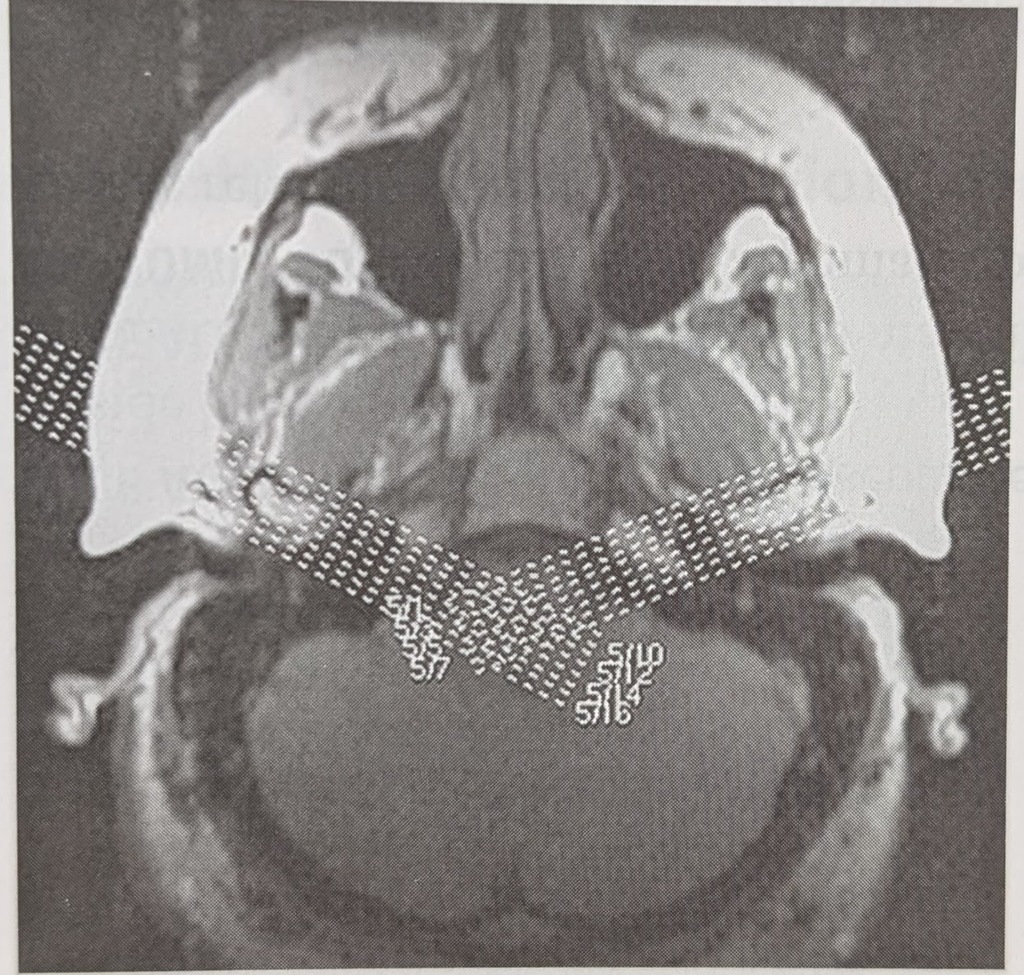 Matching Pairs: MRI Pituitary, IAC's, Orbits, MS, Temporal Lobe, and ...
