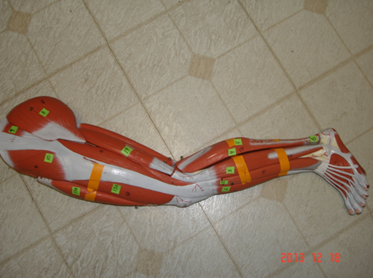 Map Quiz: Whole Left Leg - Lateral (model)