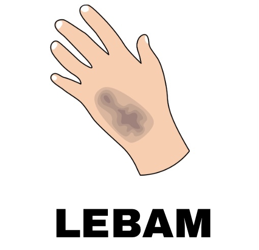 Froggy Jumps: PUNCA KECEDERAAN LEBAM DAN TERSELIUH (pedagogy)