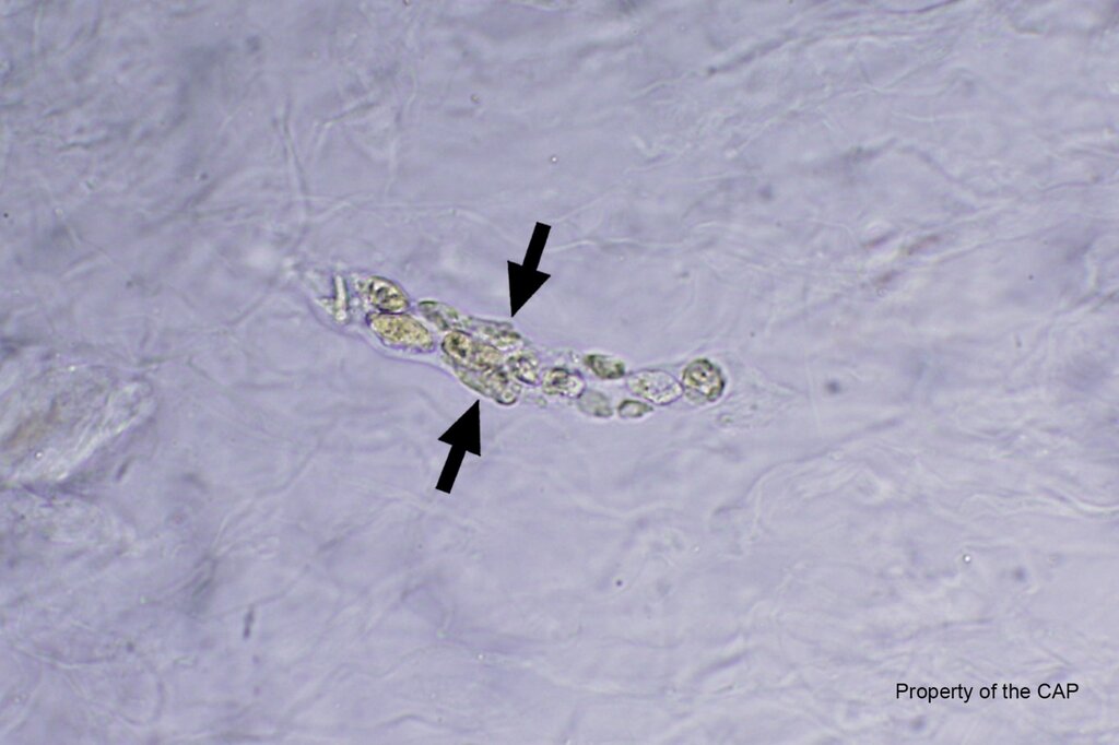 Test: 2025 Urine Microscopy Proficiency Quiz