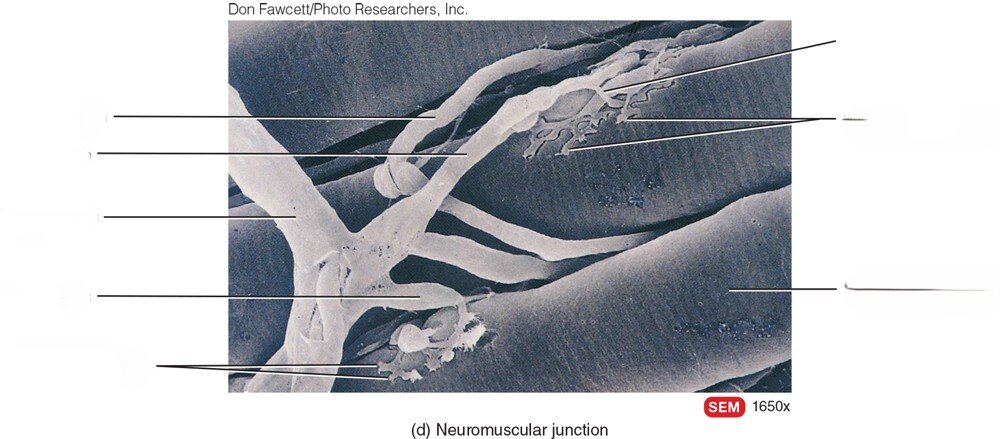 Map Quiz: Neuromuscular Junction X Ray