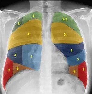 Mapa Interactivo: SEGMENTOS PULMONARES (anatomía - pulmones)
