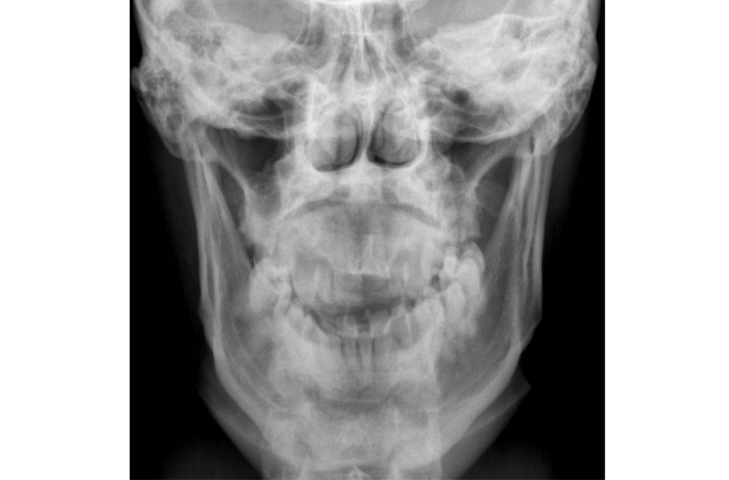 Matching Pairs: RAD5066 - Skull & Facial Projections (imaging - x-ray ...