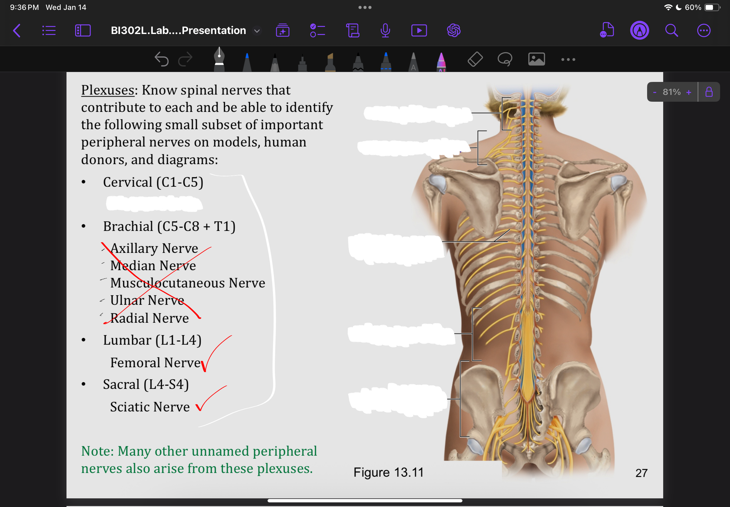 Map Quiz: Plexuses and nerves