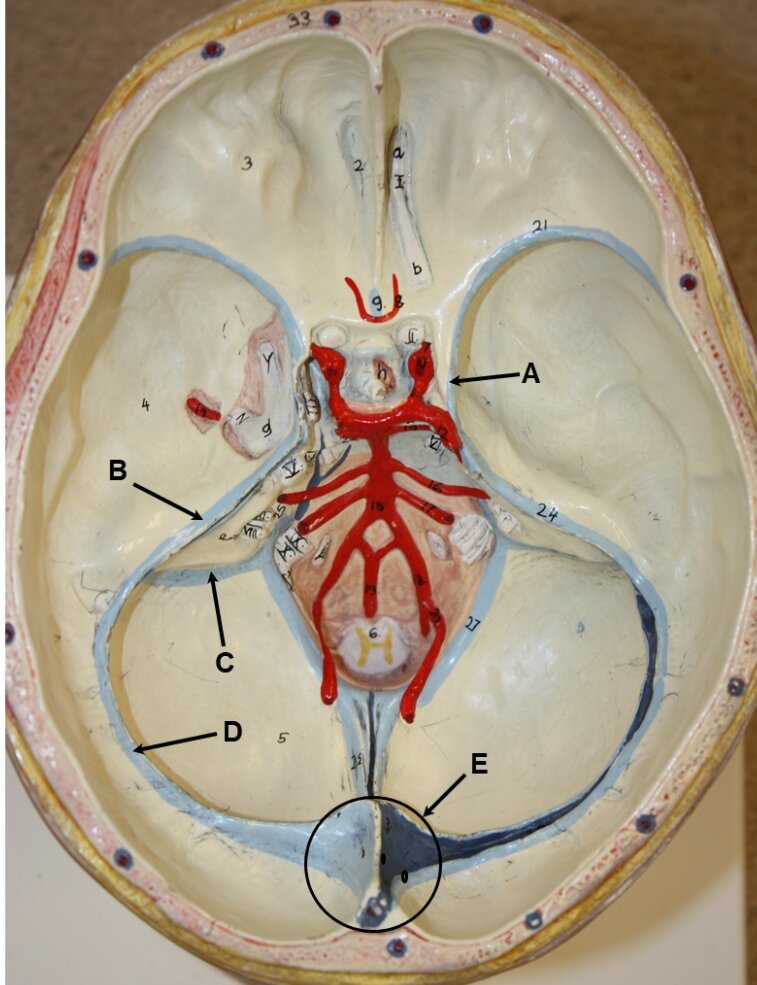 Map Quiz: BIO252 Inside head
