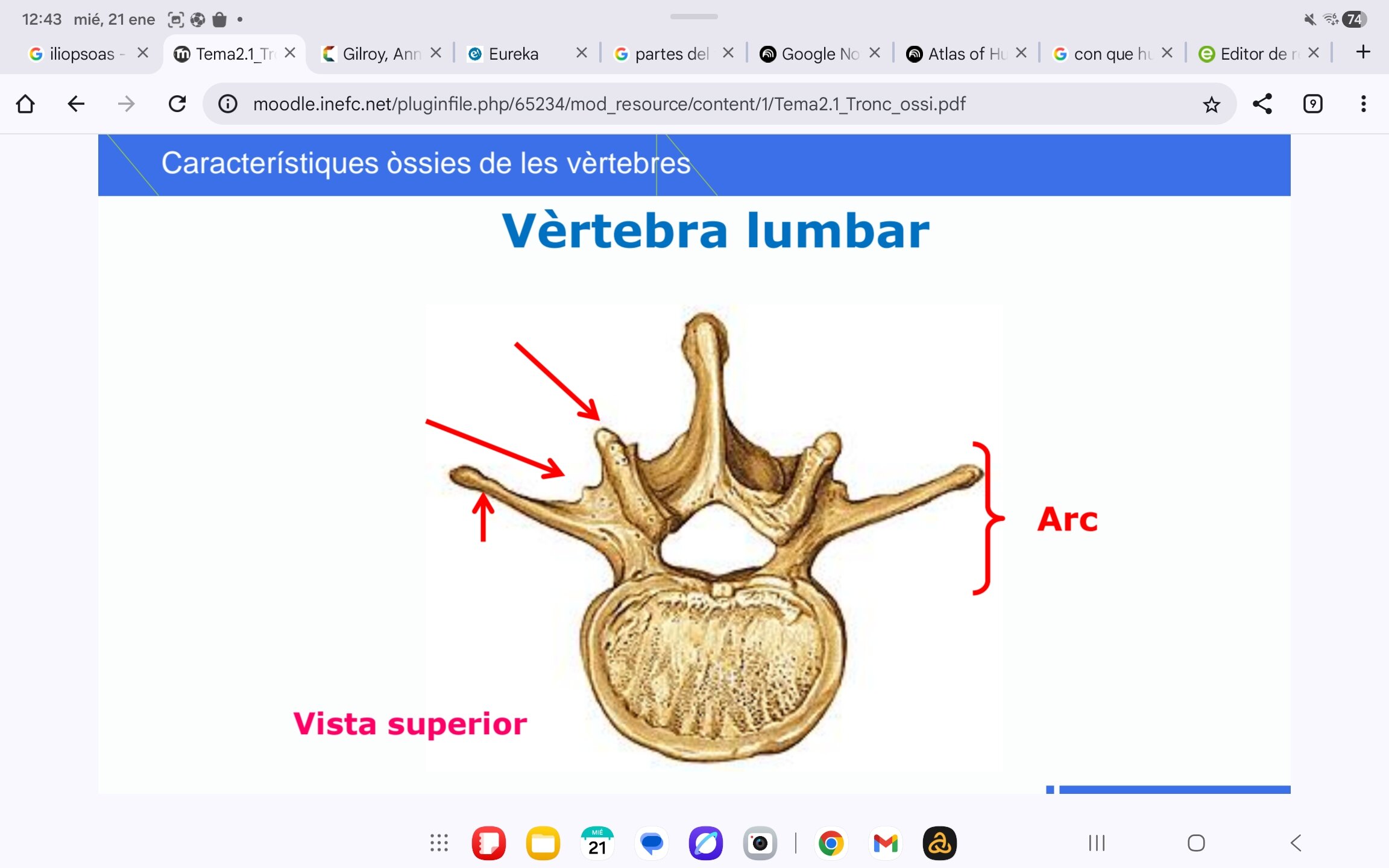 Mapa Interactivo: VERTEBRA LUMBAR