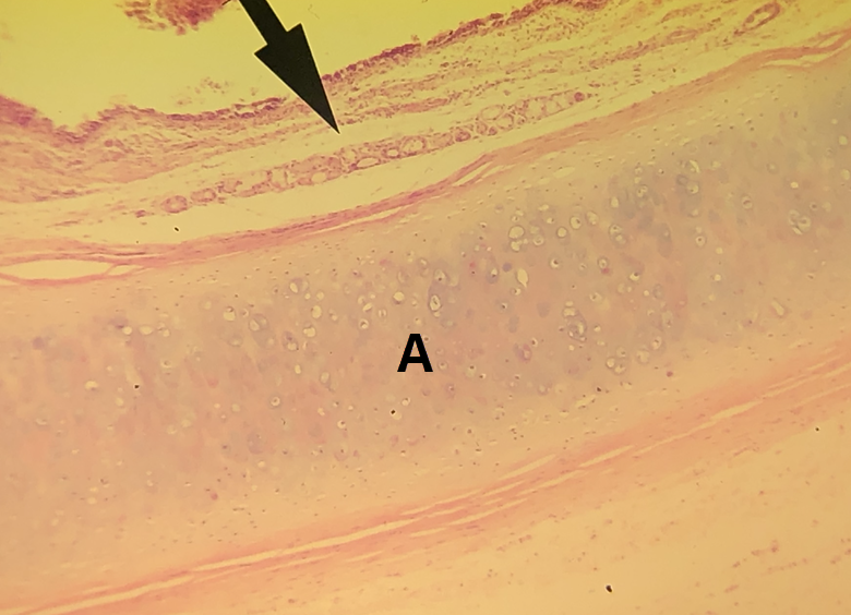 Map Quiz: trachea histology