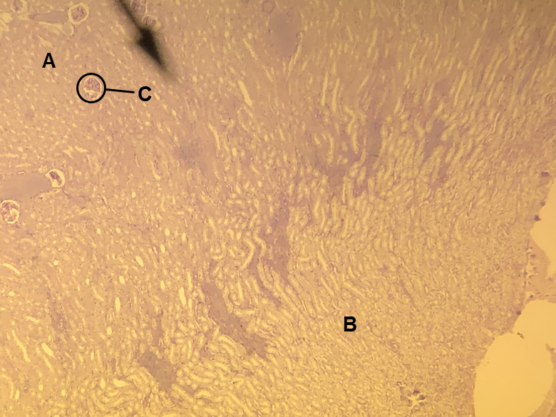 Map Quiz: urine histology 2