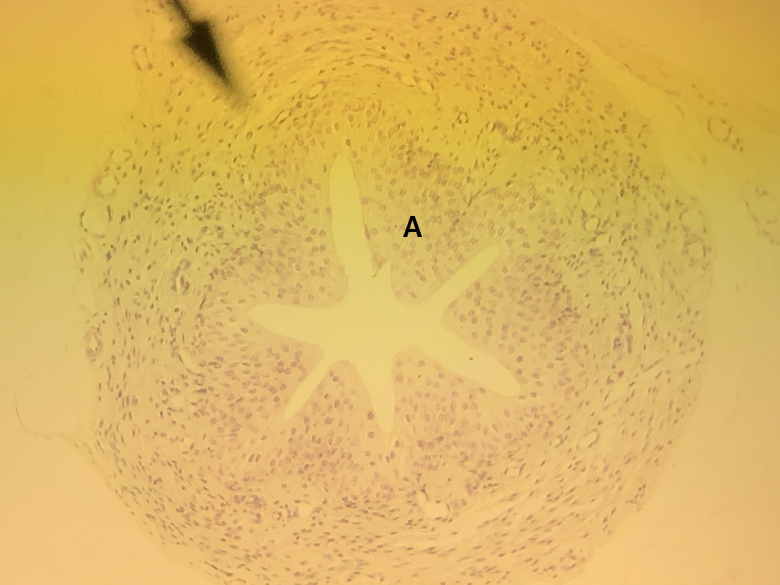 Map Quiz: urine histology 4