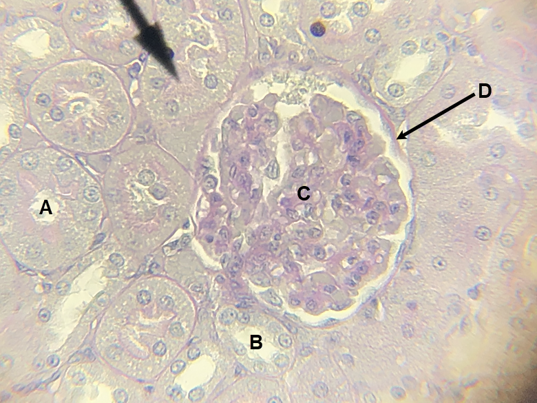 Map Quiz: urine histology 6