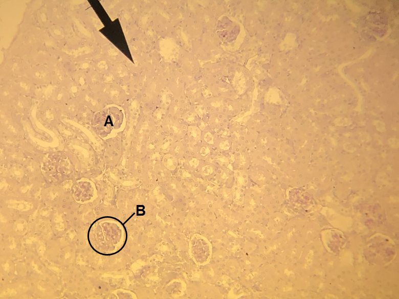 Map Quiz: urine histology 6